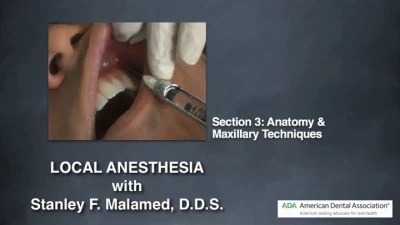 Local Anesthesia Part 9: What's New in Dental Local Anesthesia ...